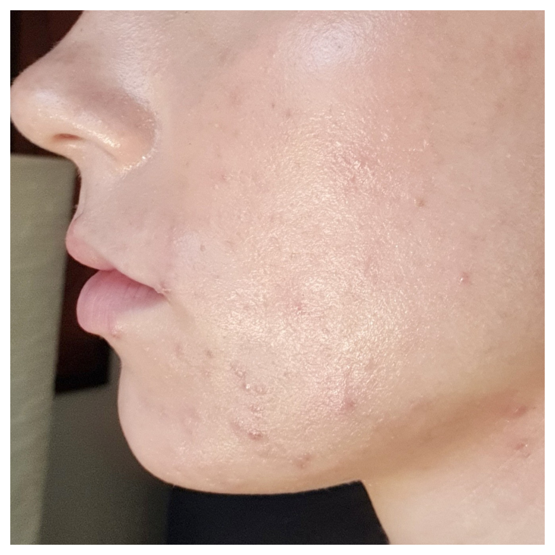 Top Skin & Cosmetics Clinic | Expert Skin Treatments | ENESIMA