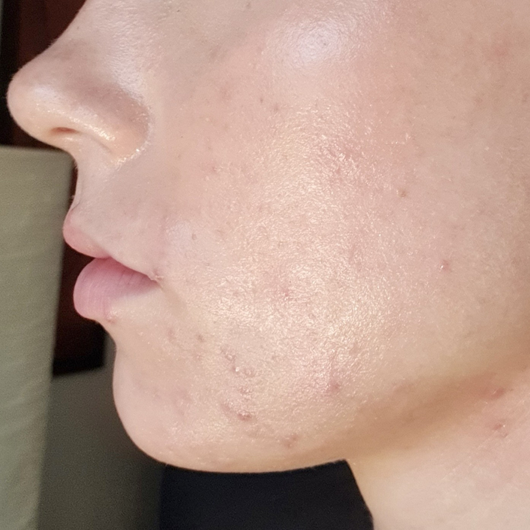 Top Skin & Cosmetics Clinic | Expert Skin Treatments | ENESIMA